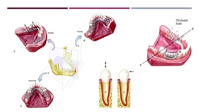 INTRODUCTION TO DIRECT RETAINERS IN CPD | PDF | Dental Health ...
