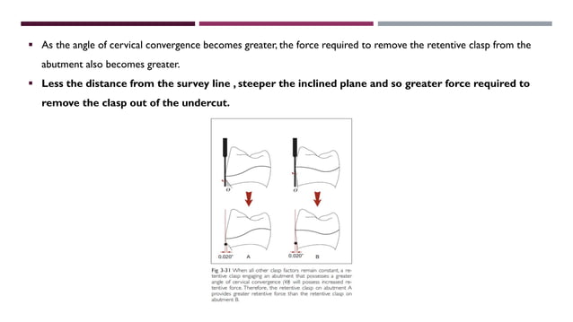 INTRODUCTION TO DIRECT RETAINERS IN CPD | PDF | Dental Health ...