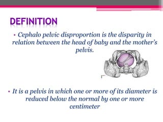 Cephalopelvic Disproportion Ppt