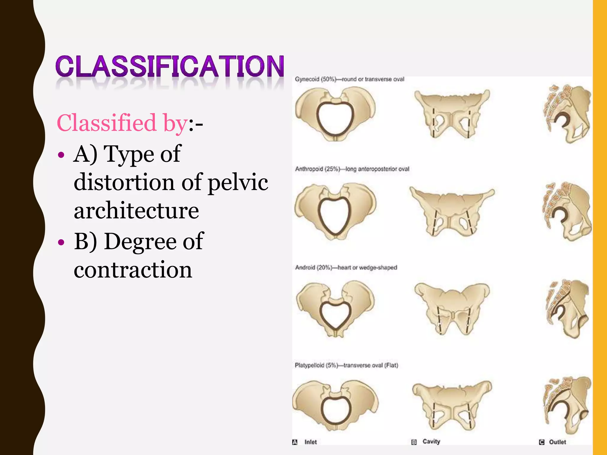 Cpd & contracted pelvis | PPTX