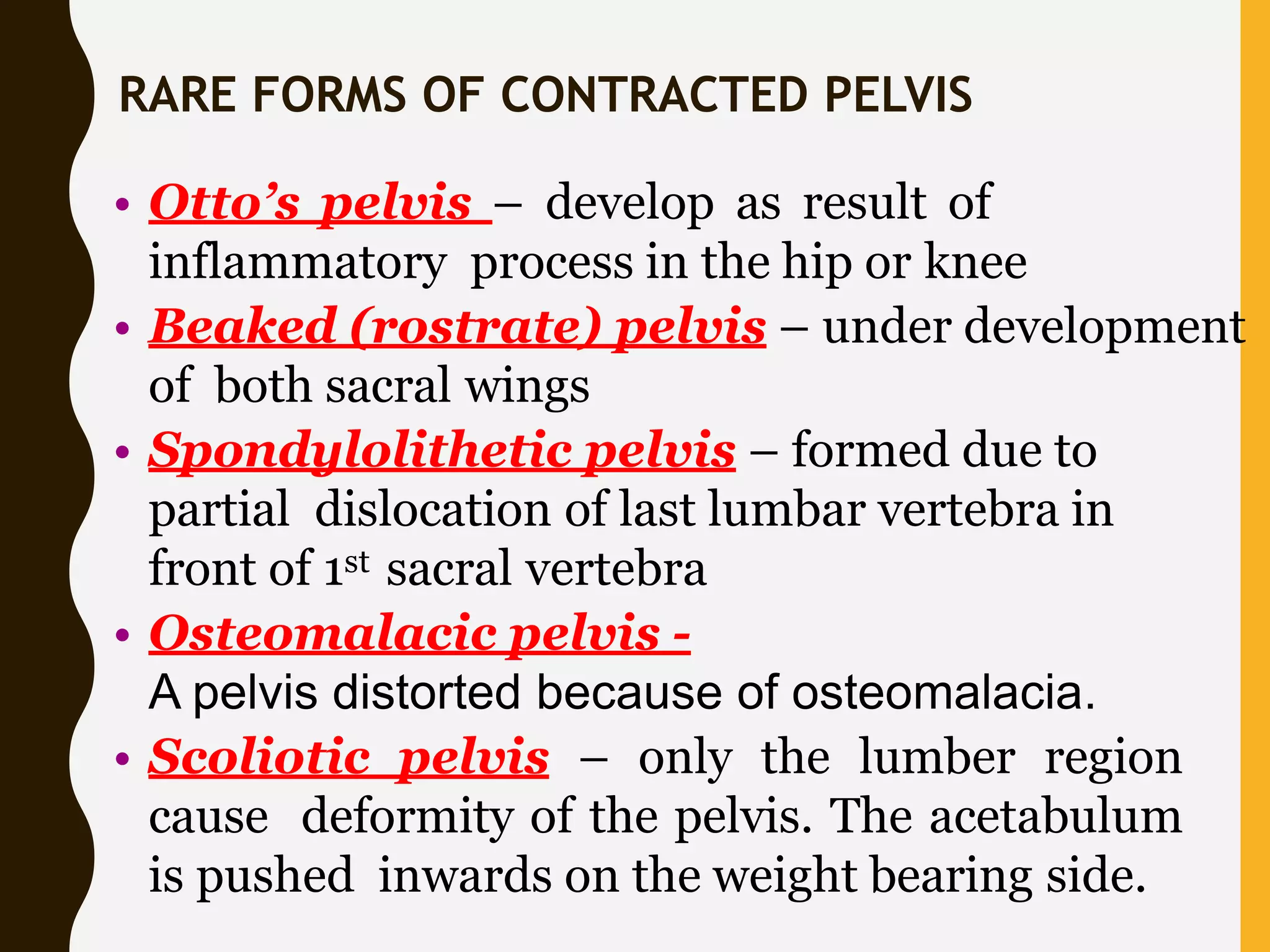 Cpd & contracted pelvis | PPTX