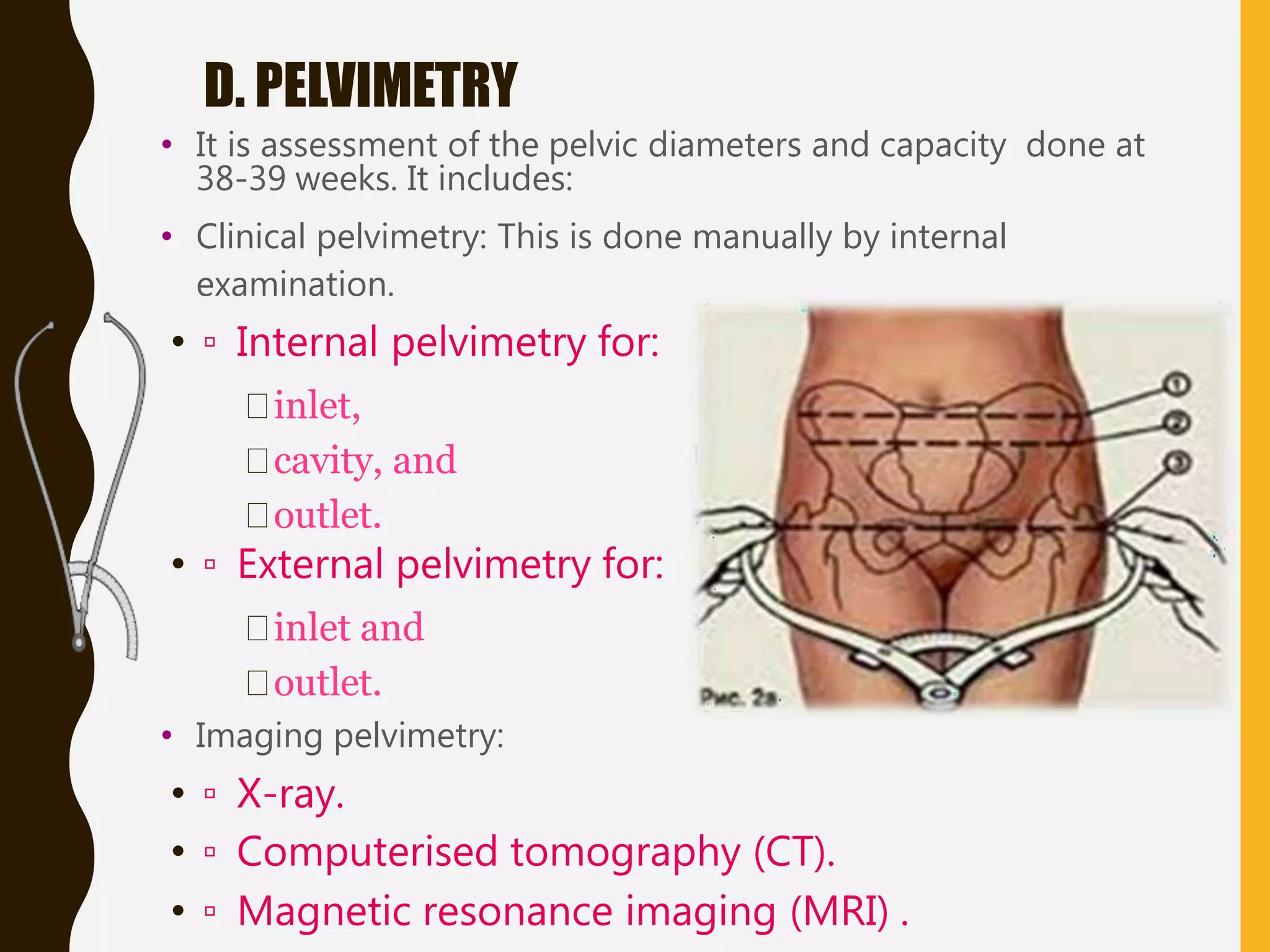 Cpd & contracted pelvis | PPTX