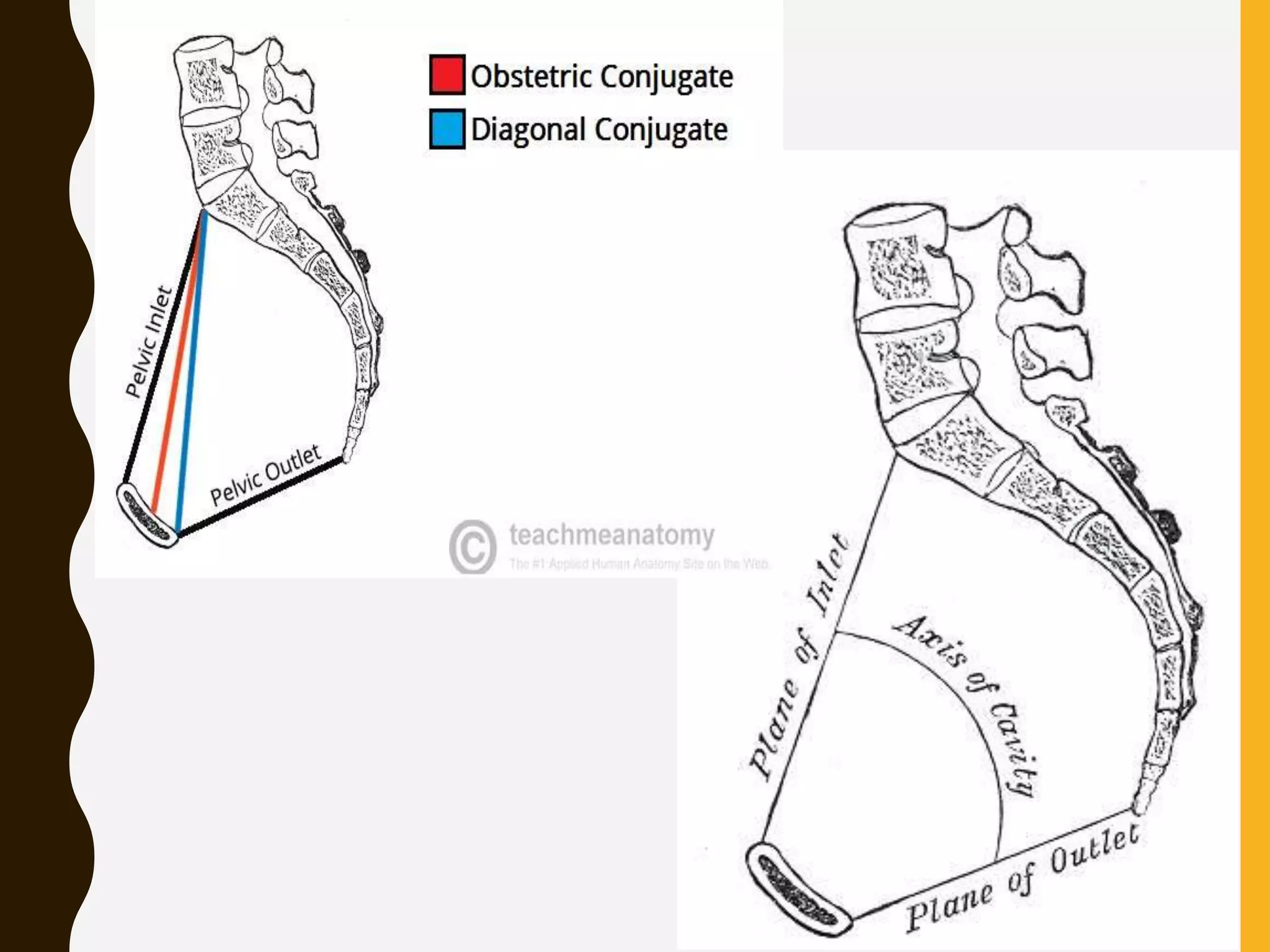 Cpd & contracted pelvis | PPTX