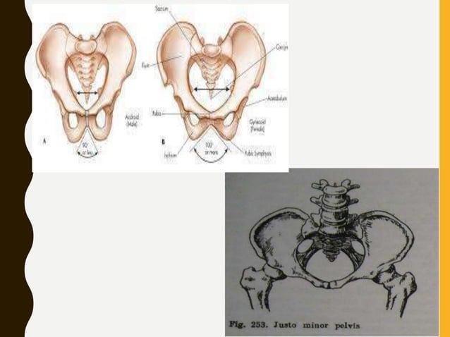 Cpd & contracted pelvis | PPTX | Pregnancy | Reproductive Health