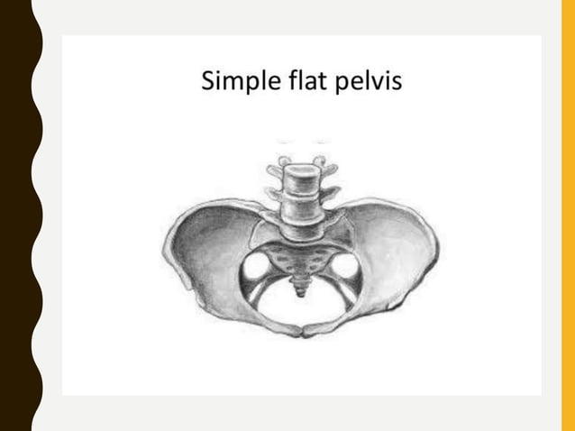 Cpd & contracted pelvis | PPTX | Pregnancy | Reproductive Health