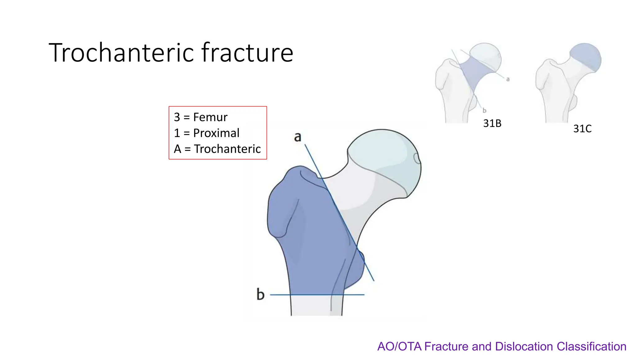 geriatric hip fracture management for elderly | PPTX