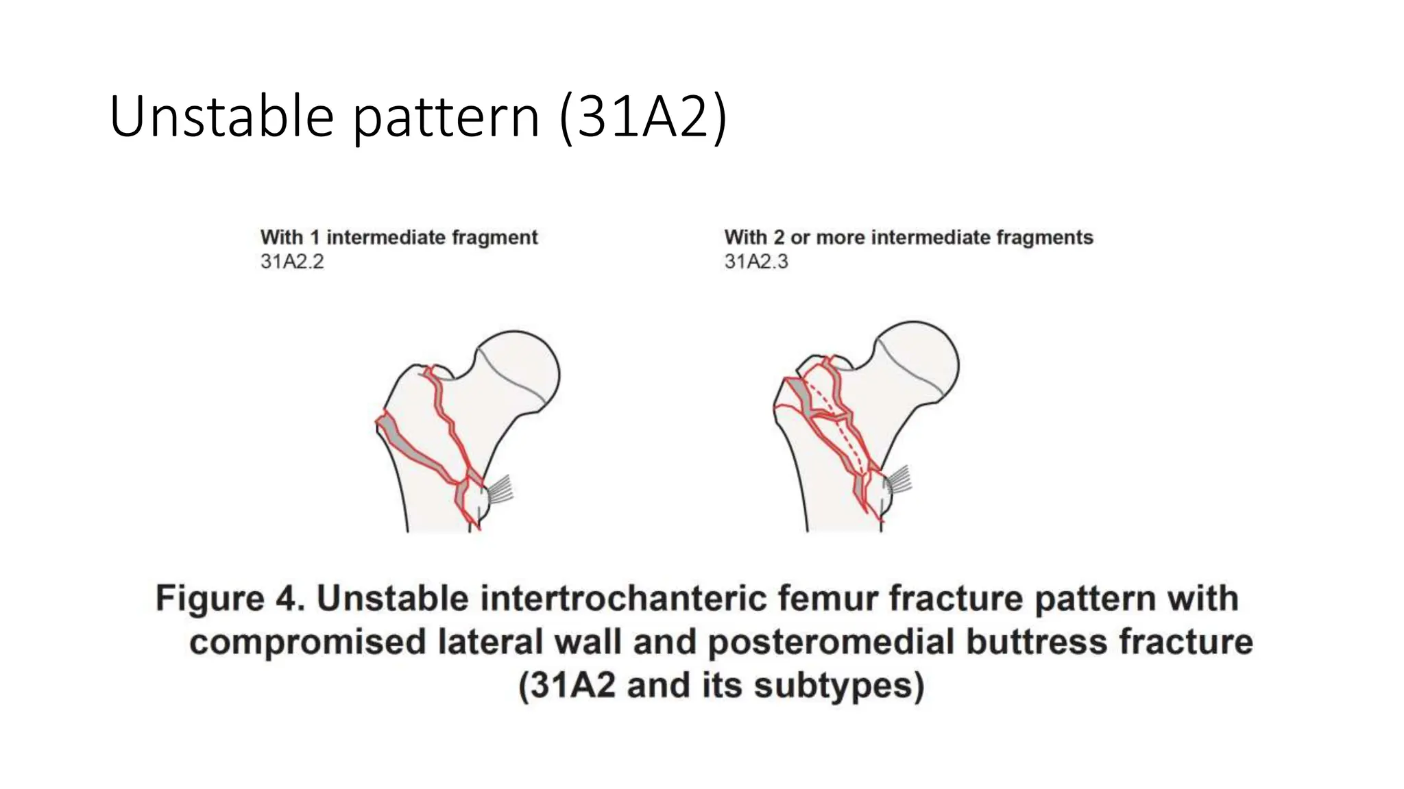 geriatric hip fracture management for elderly | PPTX