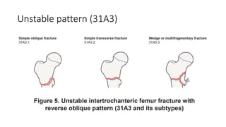 geriatric hip fracture management for elderly | PPTX