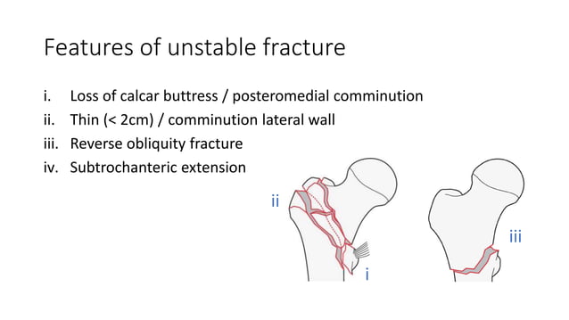 geriatric hip fracture management for elderly | PPTX