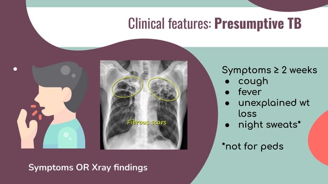 clinical practice guidelines PTB lecture | PDF | Lung and Respiratory ...