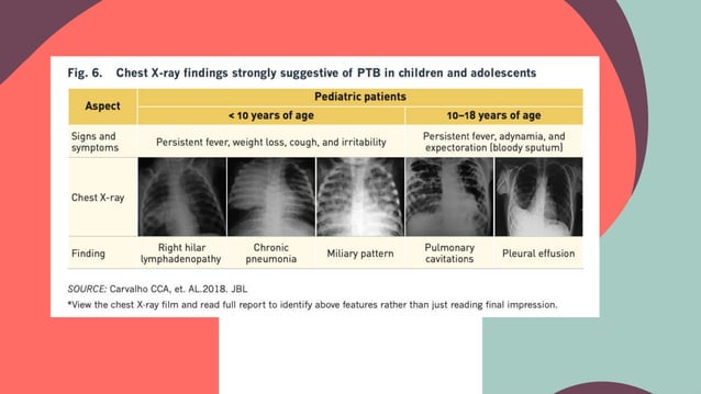clinical practice guidelines PTB lecture | PDF | Lung and Respiratory ...