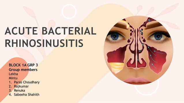 Acute bacterial rhinosinusitis and it's info | PPTX