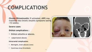 Acute bacterial rhinosinusitis and it's info | PPTX