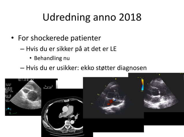 Kunne det være en lungeemboli? | PDF