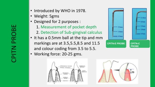 CPITN INDEX (Community Periodontal Index of Treatment Needs) | PPTX ...