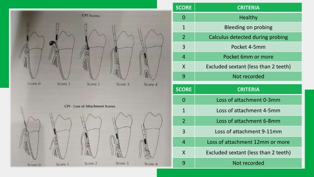 CPITN INDEX (Community Periodontal Index of Treatment Needs) | PPTX ...