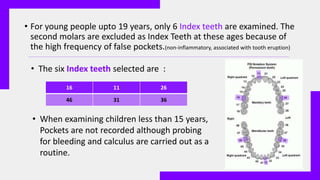 CPITN INDEX (Community Periodontal Index of Treatment Needs) | PPTX