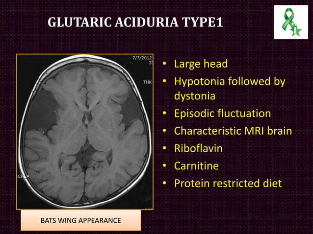 CP mimics.pptx | Brain and Nervous System Disorders | Diseases and ...