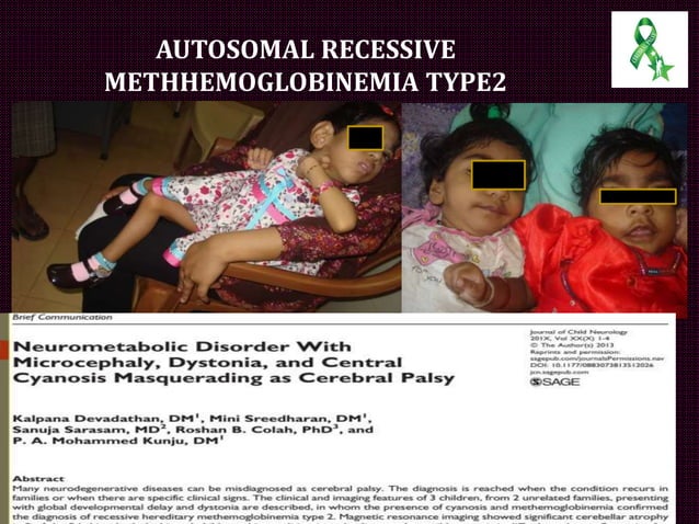 CP mimics.pptx | Brain and Nervous System Disorders | Diseases and ...