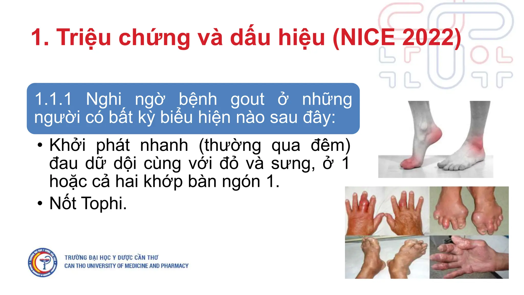 CẬP NHẬT GOUT NICE 2022.pptx
