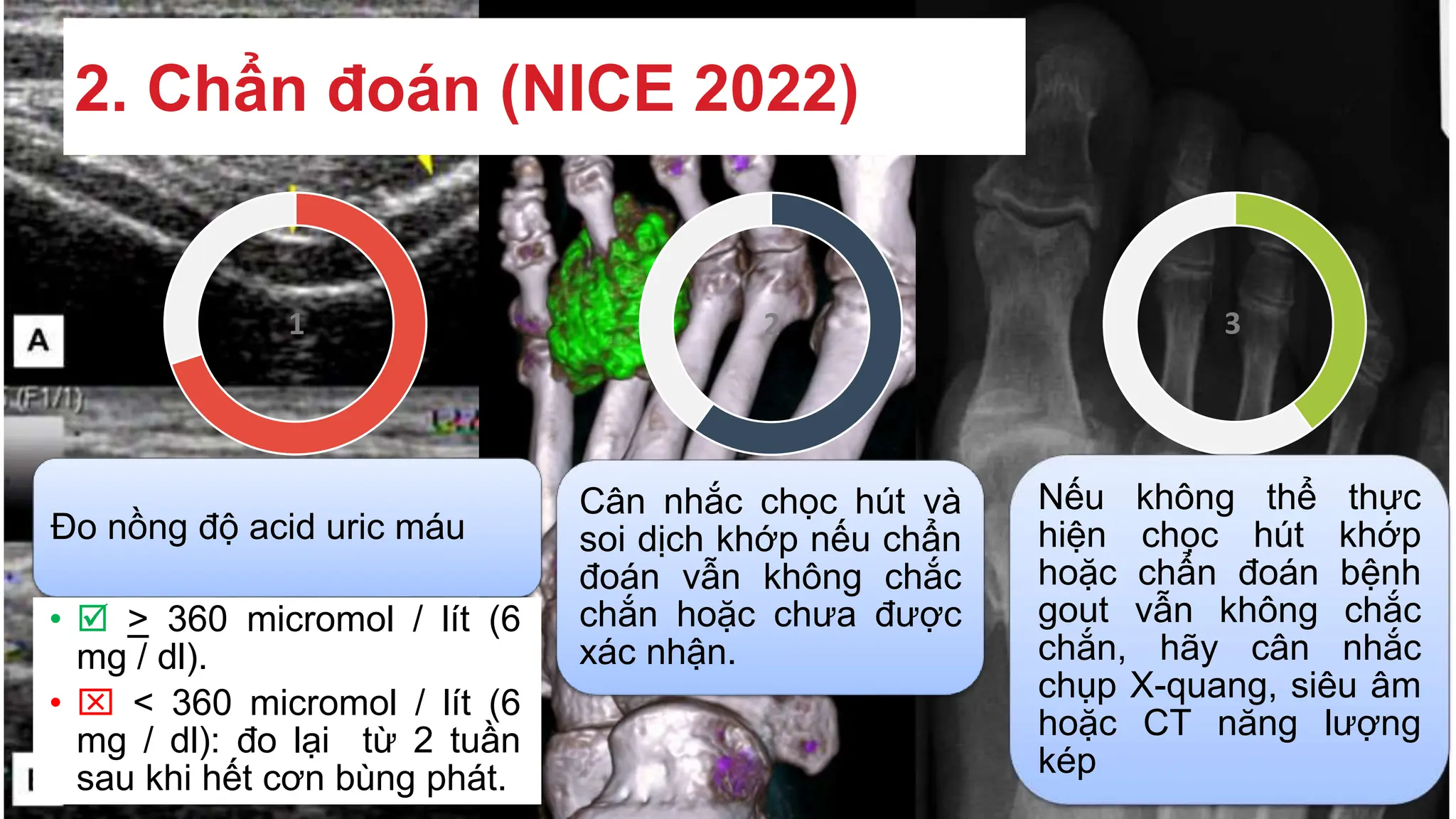 CẬP NHẬT GOUT NICE 2022.pptx