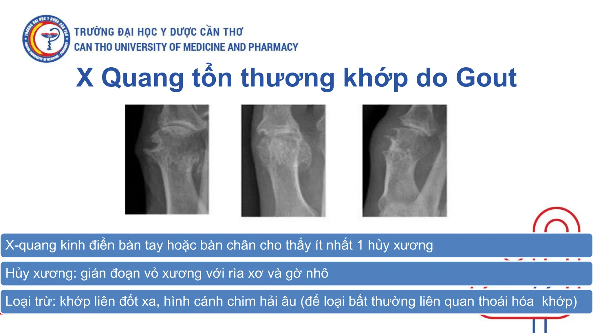 CẬP NHẬT GOUT NICE 2022.pptx