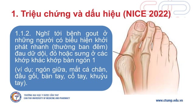 CẬP NHẬT GOUT NICE 2022.pptx