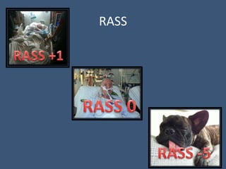 CPOT / RASS / CAM-ICU | PPTX