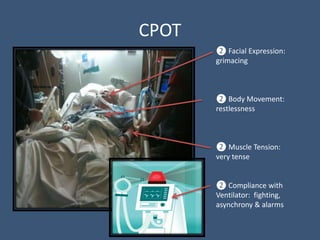 CPOT / RASS / CAM-ICU | PPTX
