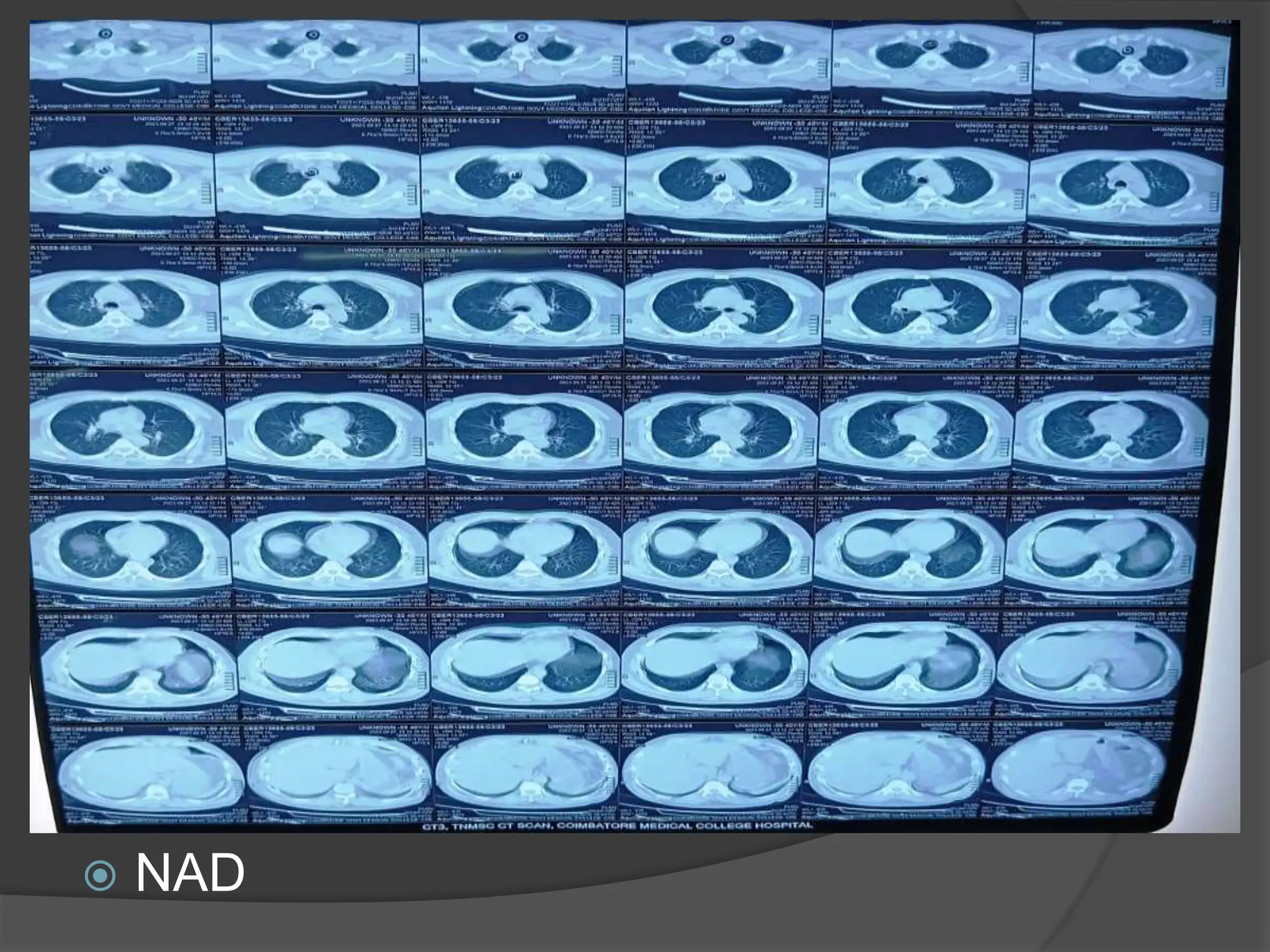 clinical polytrauma case presentation .pptx | Lung and Respiratory ...