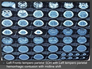 clinical polytrauma case presentation .pptx