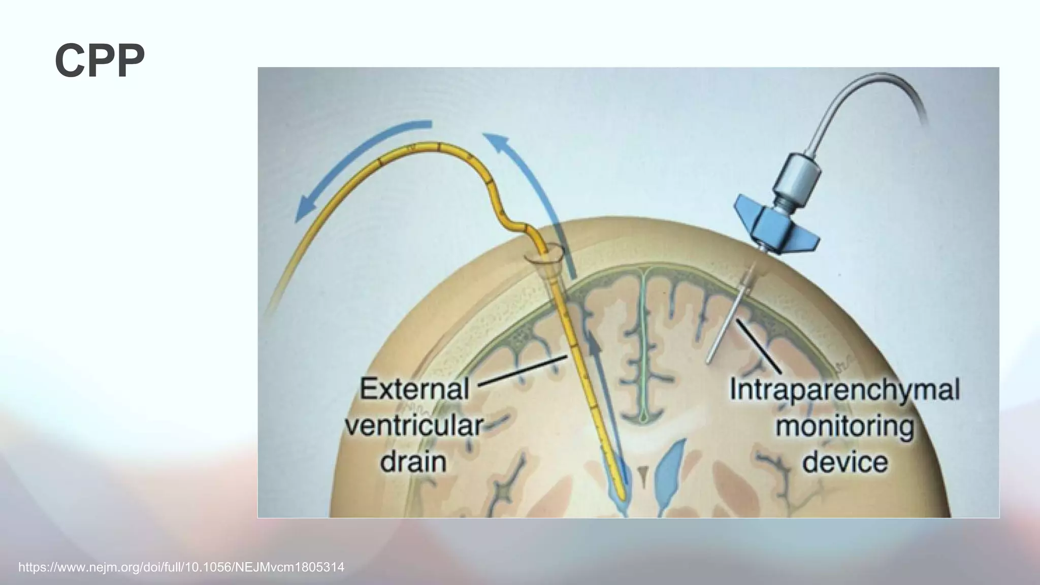 Optimal Cerebral Perfusion Pressure | PPTX