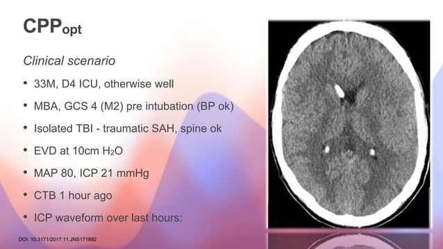 Optimal Cerebral Perfusion Pressure | PPTX | First Aid | Injuries