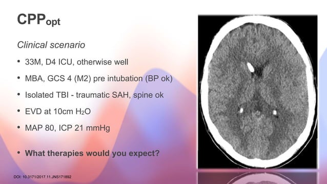 Optimal Cerebral Perfusion Pressure | PPTX | First Aid | Injuries