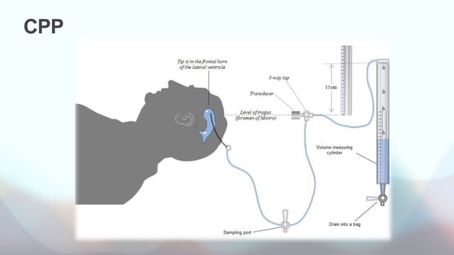 Optimal Cerebral Perfusion Pressure | PPTX | First Aid | Injuries