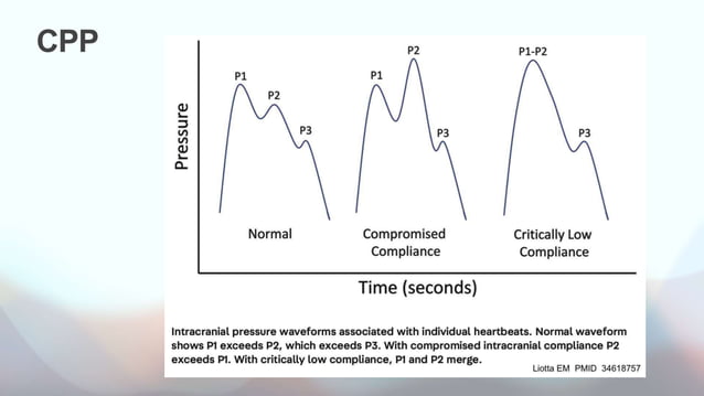 Optimal Cerebral Perfusion Pressure | PPTX | First Aid | Injuries