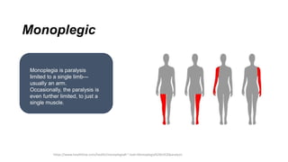 cerebral palsy and its orthotic management | PPT