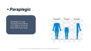 cerebral palsy and its orthotic management | PPT