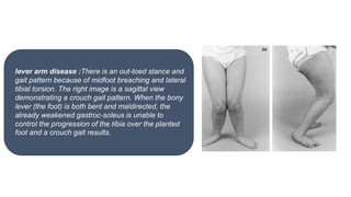 cerebral palsy and its orthotic management | PPT