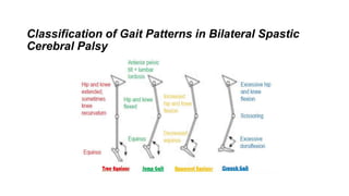 cerebral palsy and its orthotic management | PPT