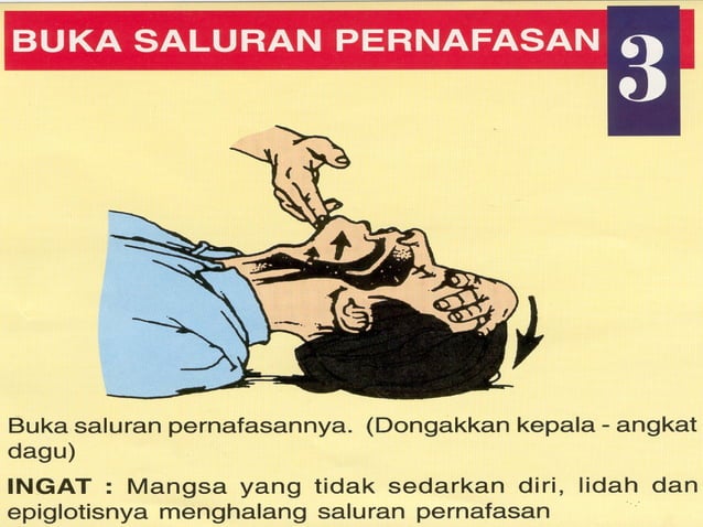 Bantuan CPR | PPT