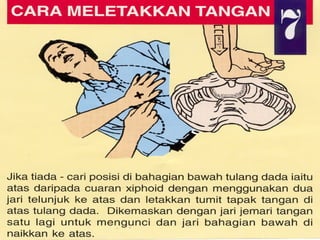 Bantuan CPR | PPT