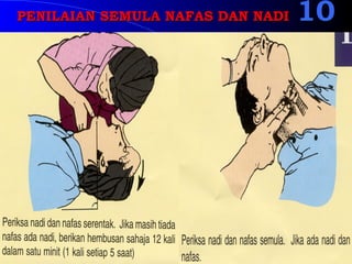 Bantuan CPR | PPT