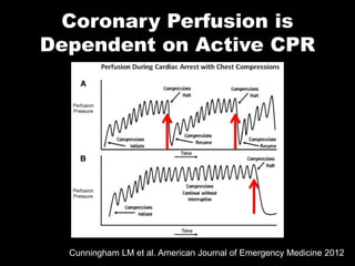 CPR That Saves Lives | PPT