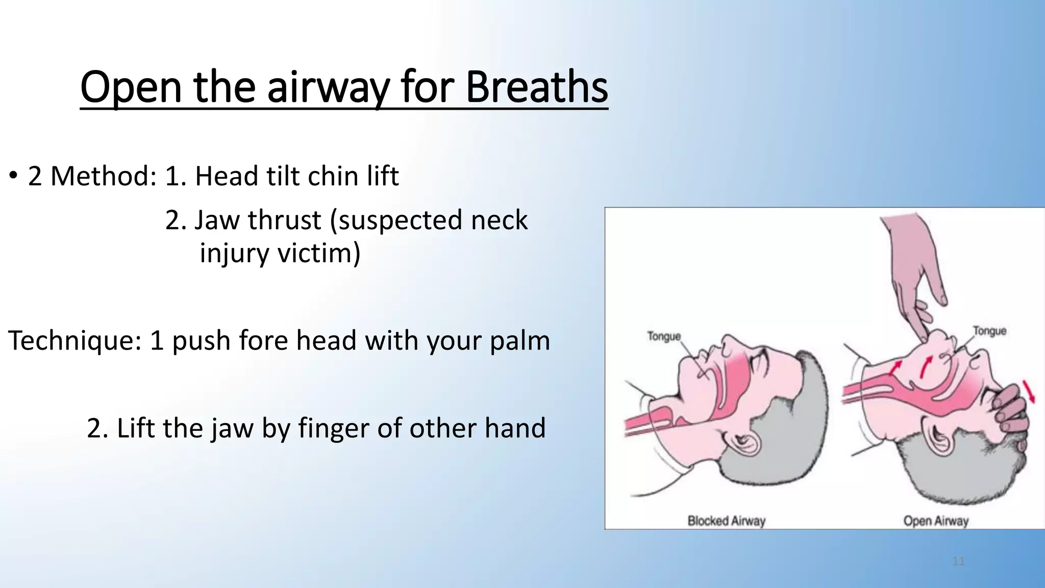 basic life support or CPR | PPTX