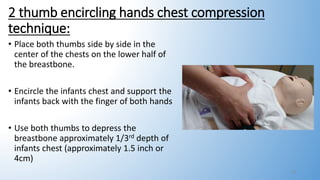 basic life support or CPR | PPT