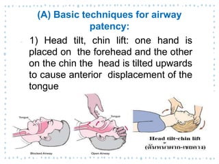 CPR | PPTX