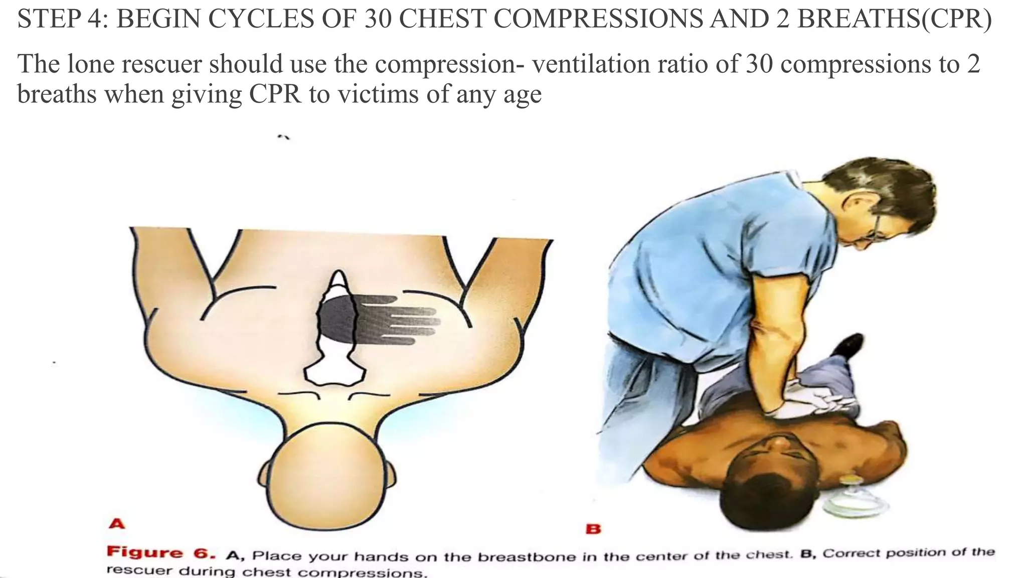 Cpr | PPT | Free Download