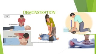 CPR procedure | PPTX