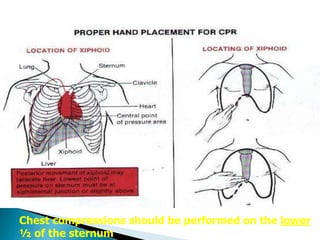 cpr.ppt